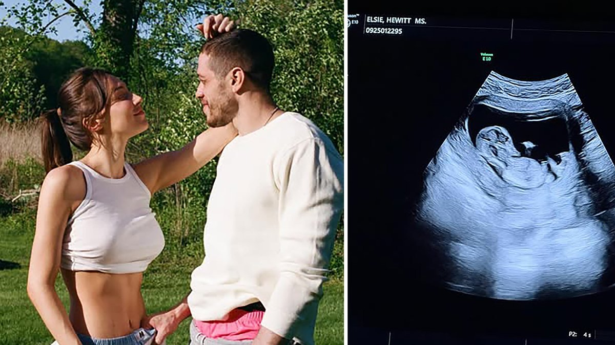 Elsie Hewitt Reveals Painful Pregnancy Struggles with Hypermobile ...