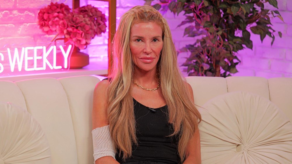 Face Parasite Diagnosis Finally Revealed Brandi Glanville Drops Huge ...