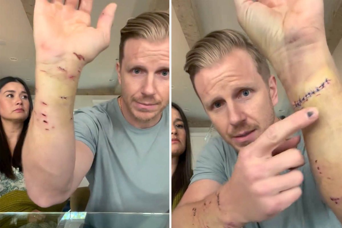 Sean Lowe Reveals PTSD After Family Dog Attack and What It Means for ...