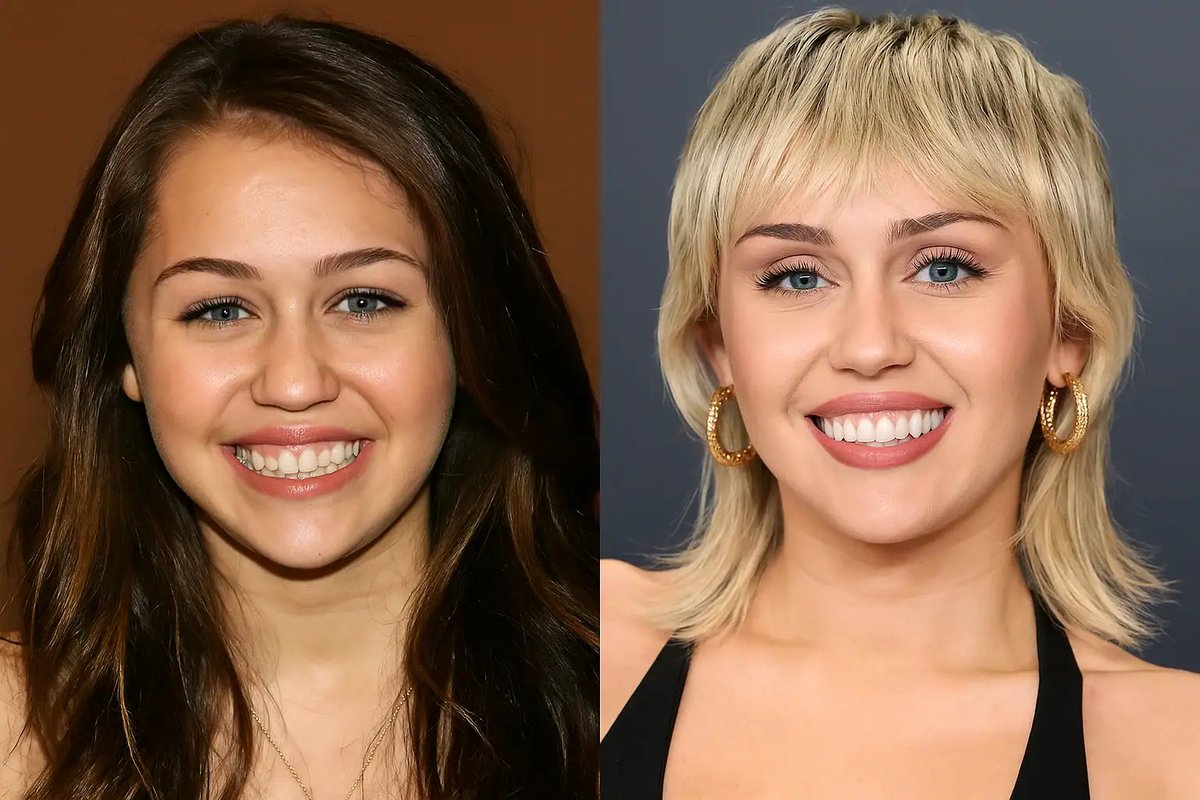 At Home Hair Removal Hacks That Actually Work Now - Celebrity Storm