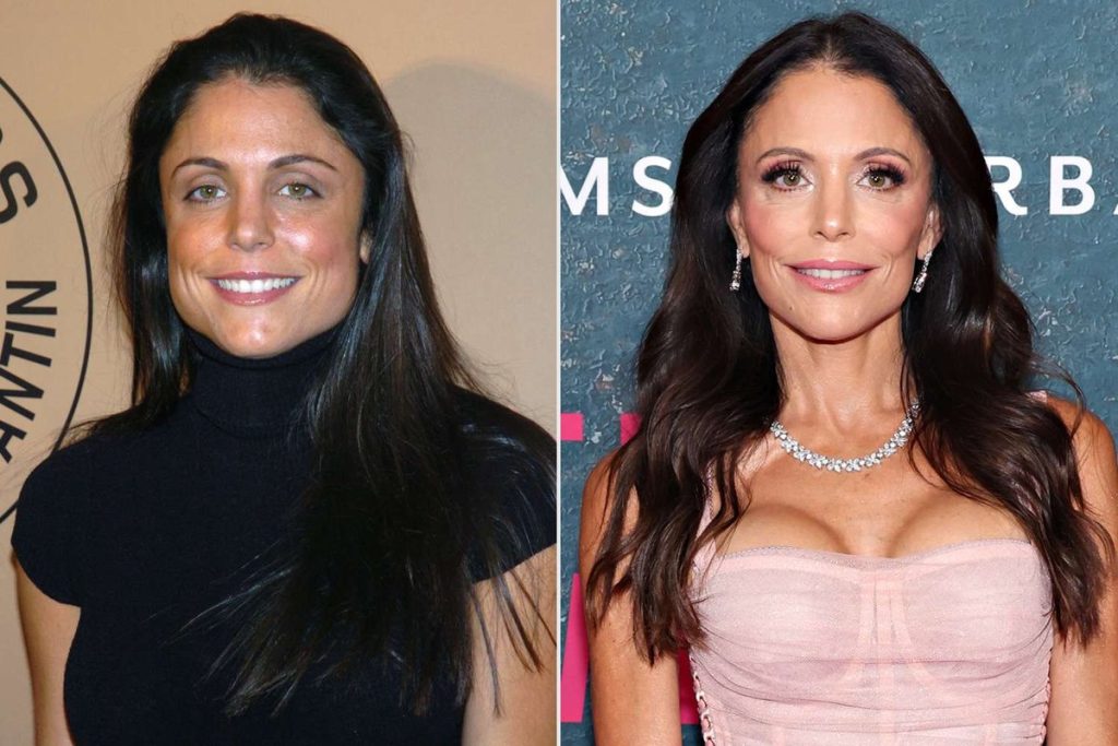 Bethenny Frankel Faces Bacterial Face Infection After St Barths Getaway ...