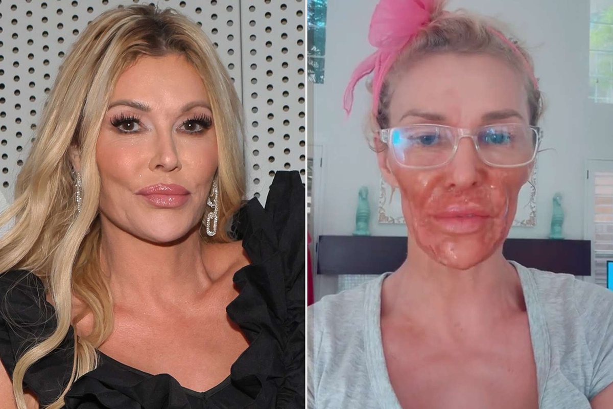 Brandi Glanville’s Post Disfigurement Glow Up Sparks Public Comeback ...